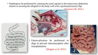 Recent Advances in Surgical Affections of Kidney with special reference ...