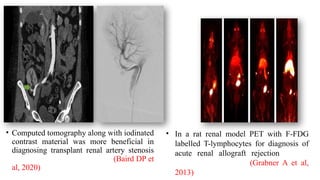 Recent Advances in Surgical Affections of Kidney with special reference ...