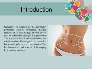 Liposuction | PPTX