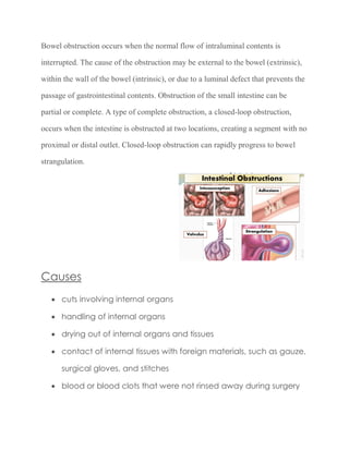 Adhesive Bowel Obstruction | PDF
