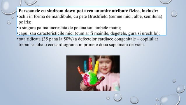 Sindromul Down | PDF