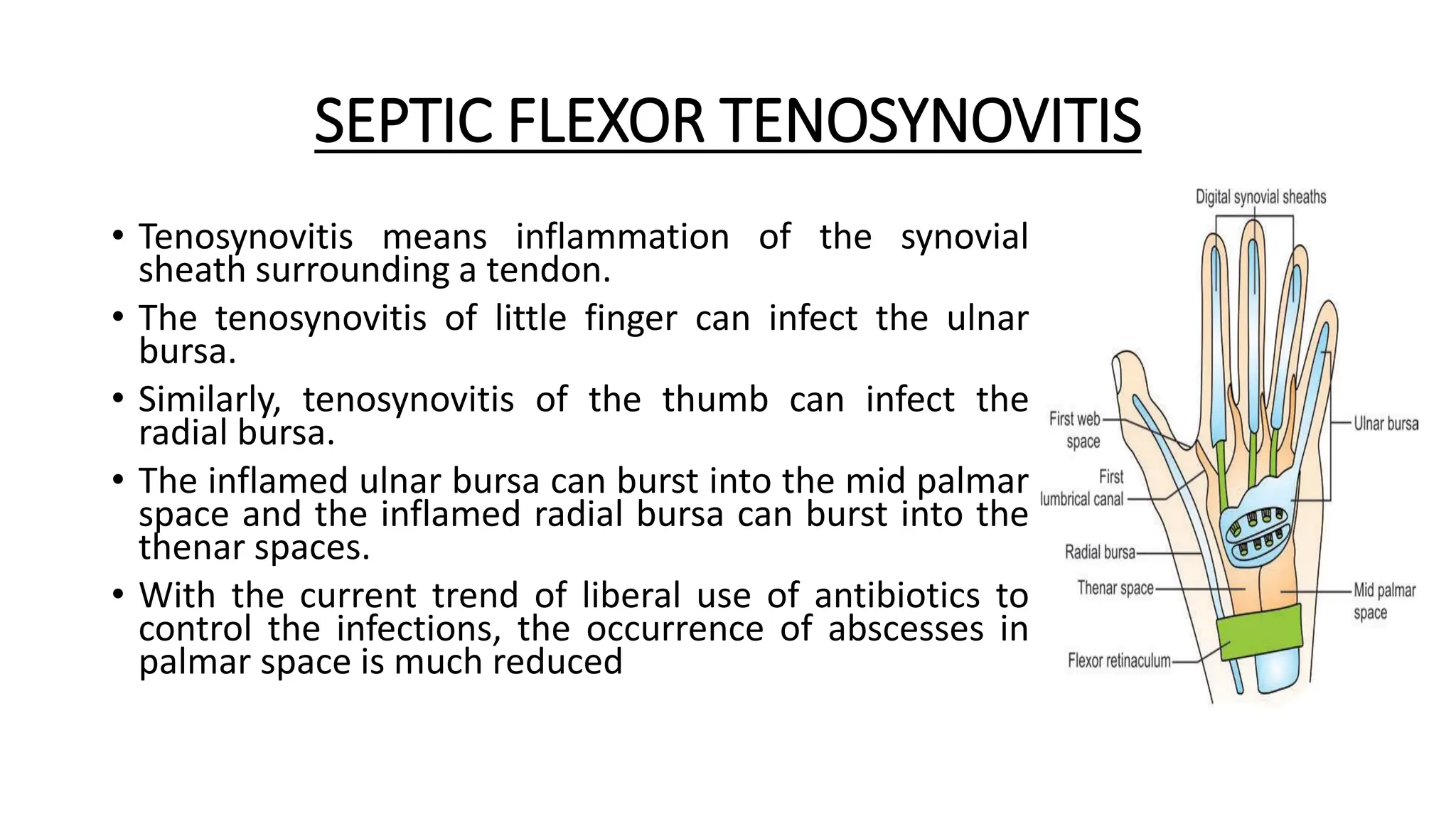 documents_null-ANATOMY+OF+HAND+SPACE,+INFECTIONS+OF+HAND (2).pdf