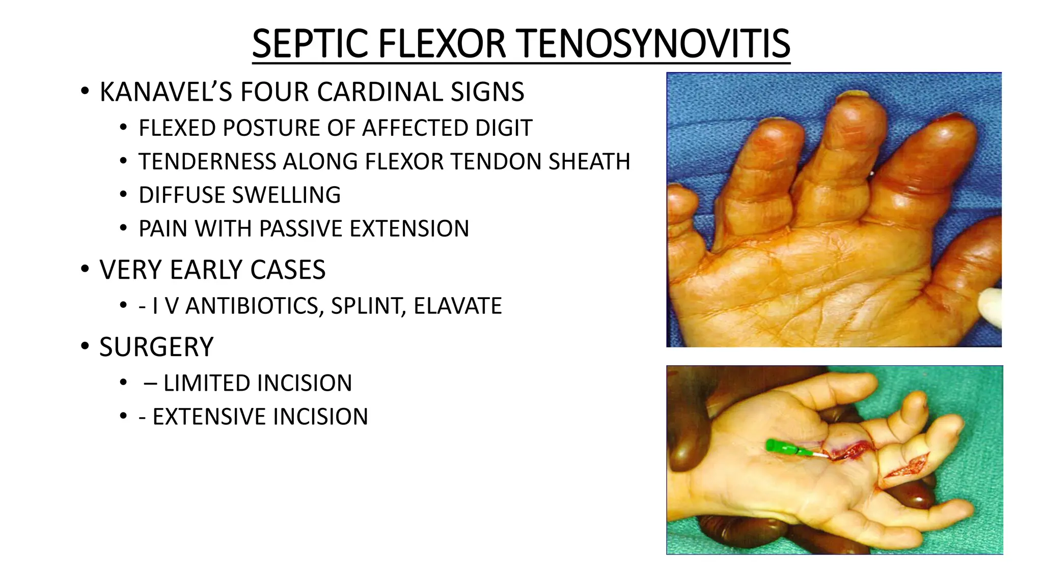 documents_null-ANATOMY+OF+HAND+SPACE,+INFECTIONS+OF+HAND (2).pdf