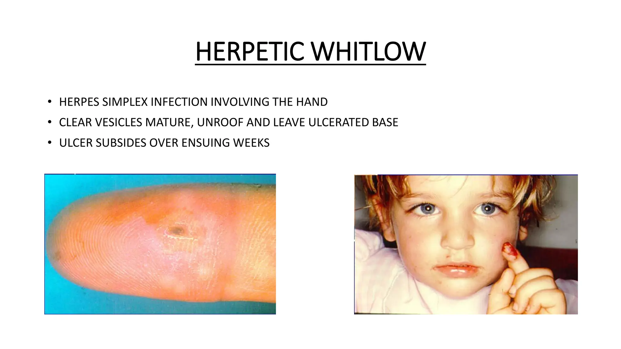 documents_null-ANATOMY+OF+HAND+SPACE,+INFECTIONS+OF+HAND (2).pdf