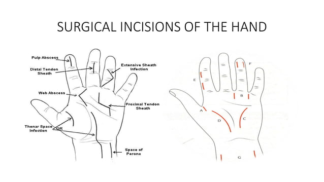 documents_null-ANATOMY+OF+HAND+SPACE,+INFECTIONS+OF+HAND (2).pdf