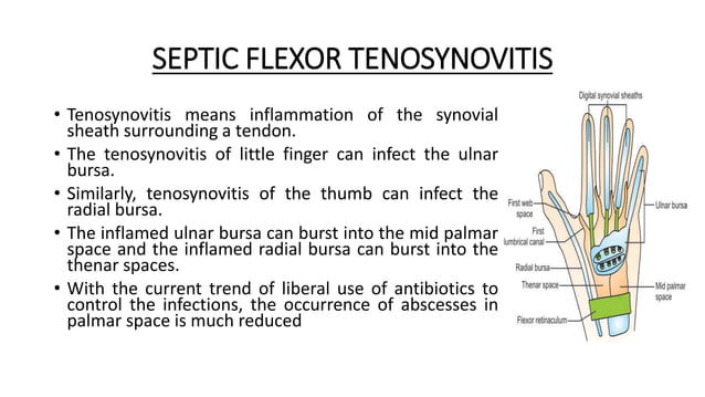 documents_null-ANATOMY+OF+HAND+SPACE,+INFECTIONS+OF+HAND (2).pdf
