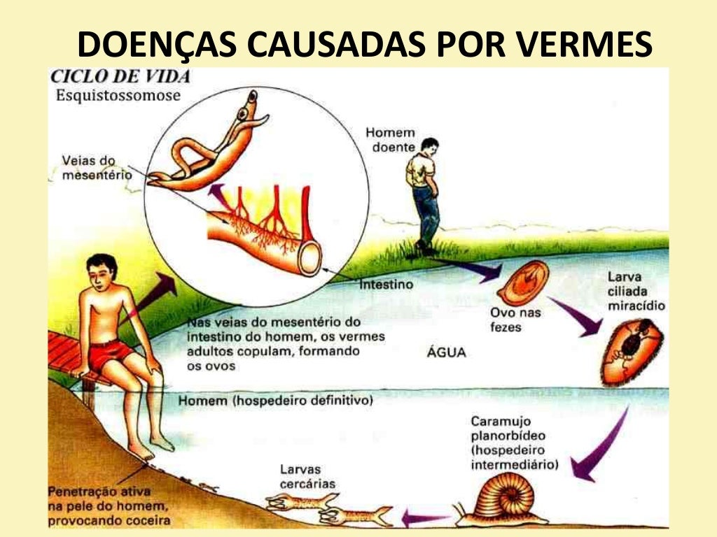 Doenças causadas por vermes
