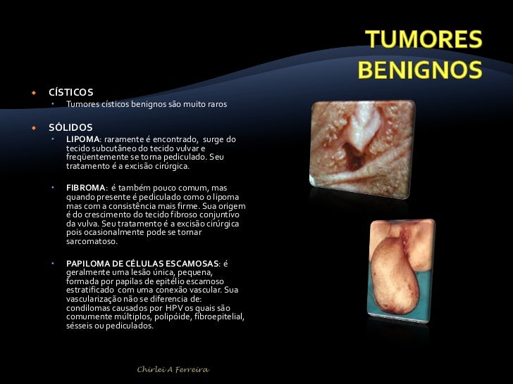 DoençAs Da Vulva1