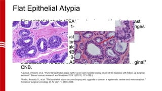 Does flat epithelial atypia always need excision | PPT
