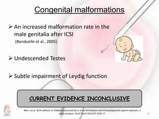 Does icsi causes genetic defects | PPTX