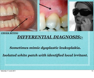 D of keratotic white lesions | PDF