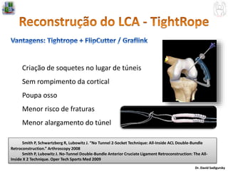 Reconstrução do Ligamento Cruzado Anterior com técnica All-inside ...
