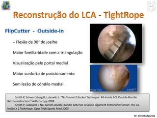 Reconstrução do Ligamento Cruzado Anterior com técnica All-inside ...