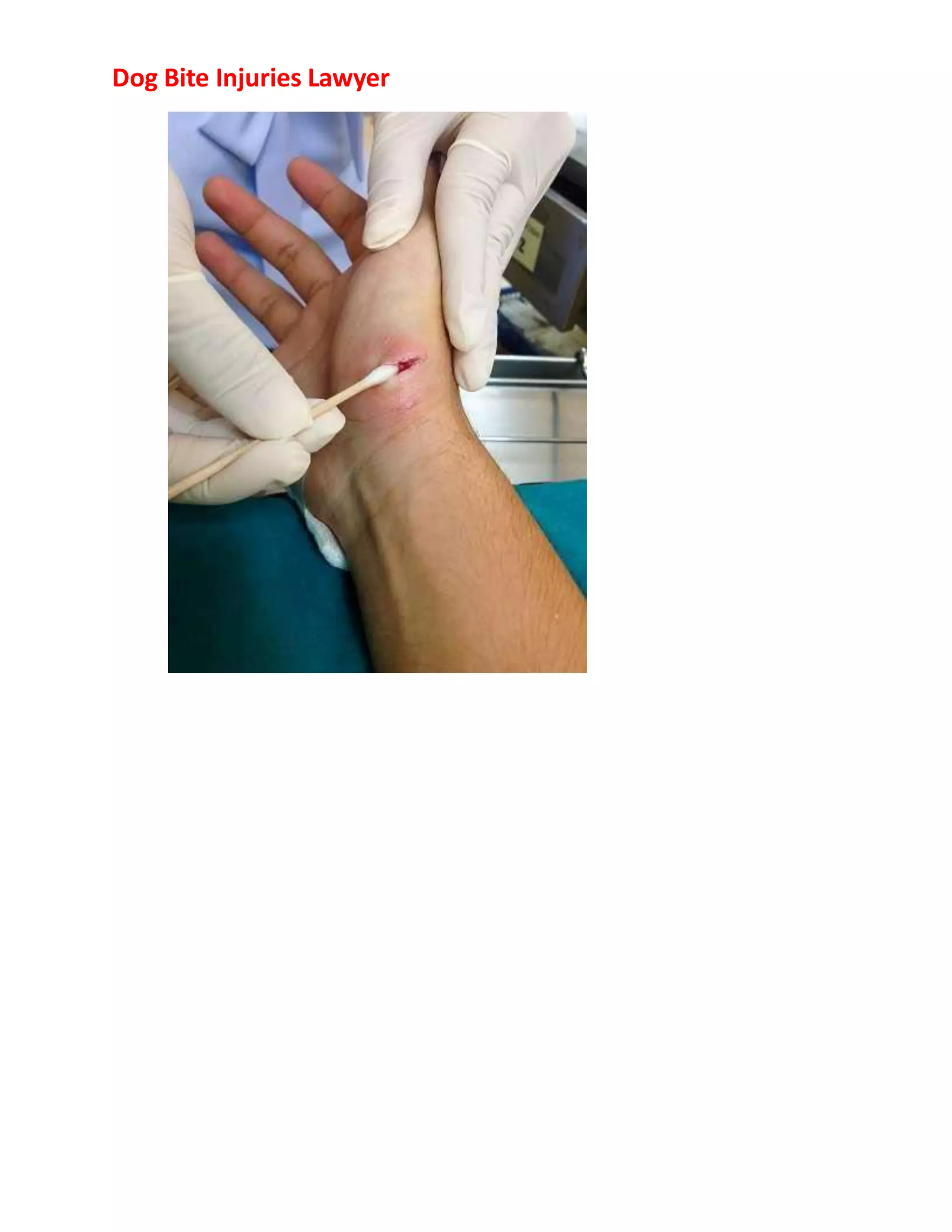 Dog Bite.ppt