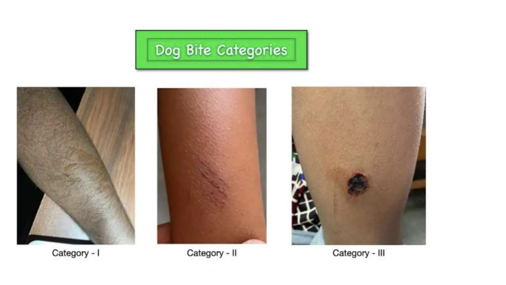 DOG BITE management in pediatrics # for Pediatric pgs# topic ...