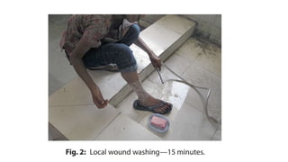 DOG BITE management in pediatrics # for Pediatric pgs# topic ...