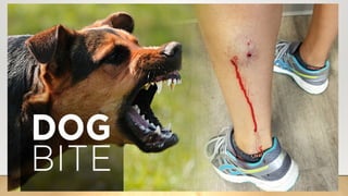 Dog bite prevention and aid with first aid | PPTX