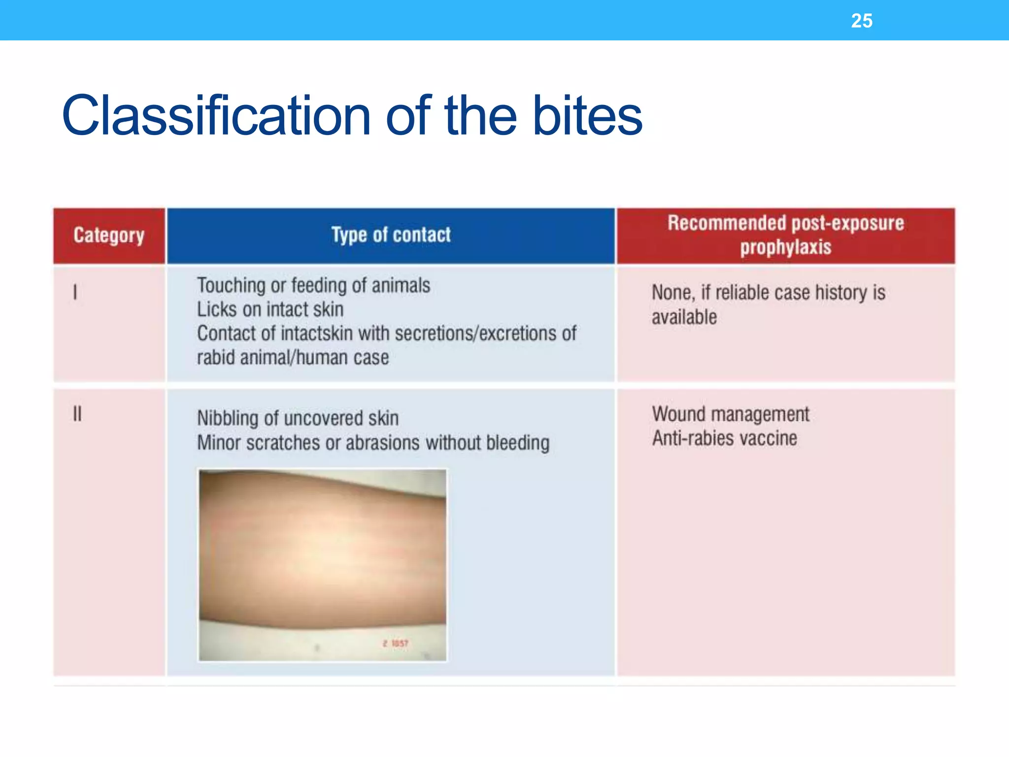 DOG BITE and it's Management-RAVINDRA G O | PPTX