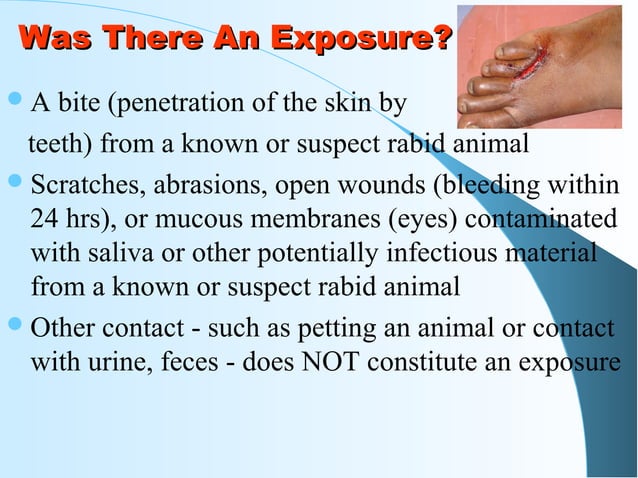 Dog bite (rabies) | PPT | Infectious Diseases | Diseases and Conditions