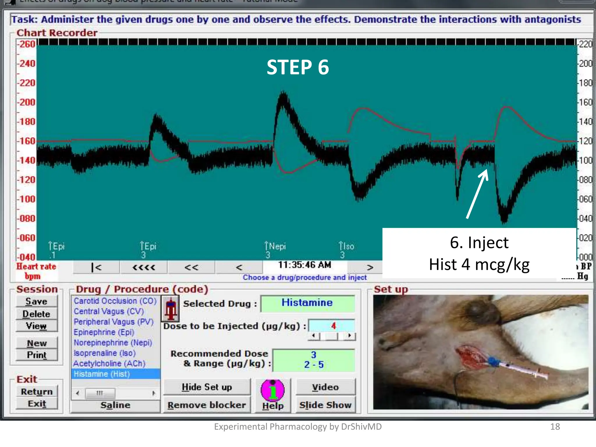 Effect of Drugs on Dog's Blood Pressure using CAL (Computer aided ...