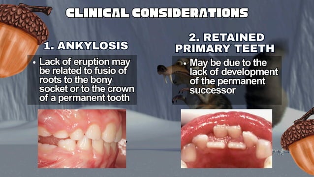 Physiology of tooth movement powerpoint presentation | PPT