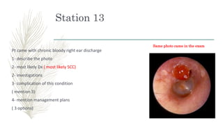 DOHNS OSCE Exam 21 02 2018, Dublin | PPTX
