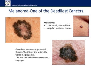 Do i have skin cancer? | PPTX