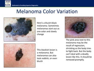 Do i have skin cancer? | PPTX