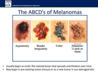 Do i have skin cancer? | PPTX
