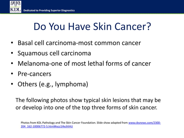 Do i have skin cancer? | PPT