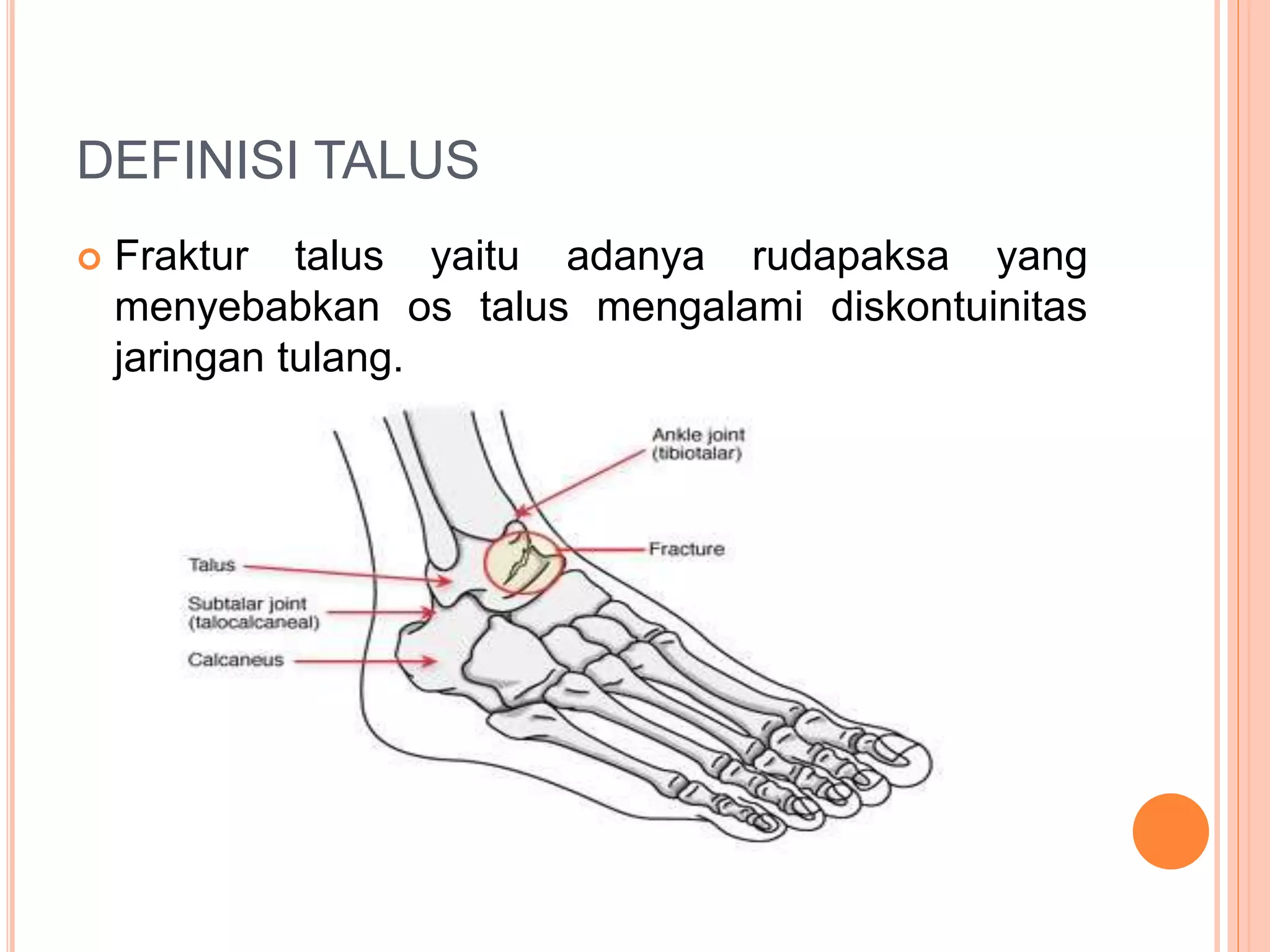 dokumen.tips_fraktur-talus-.pptx