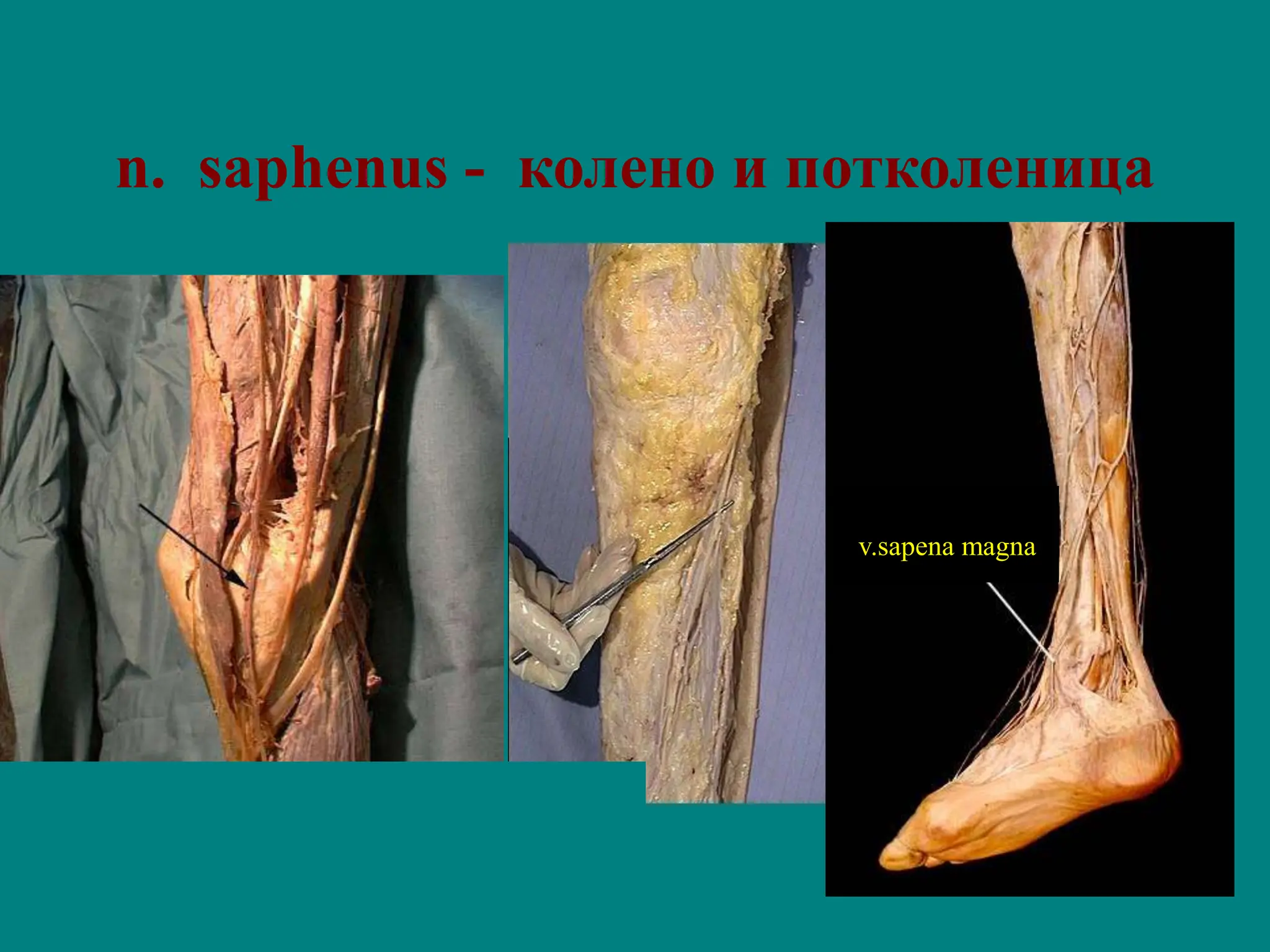 dokumen.tips_nervi-donjeg-ekstremiteta.ppt
