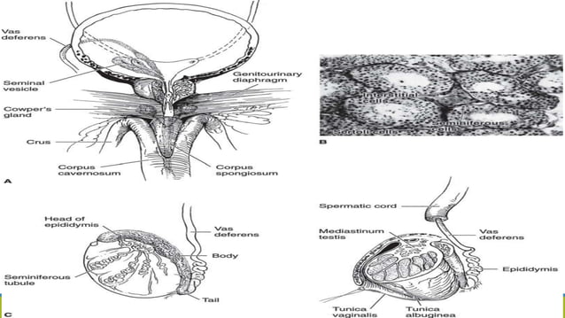 dokumen.tips_varikokel-2-567bcd03e02c6.pptx