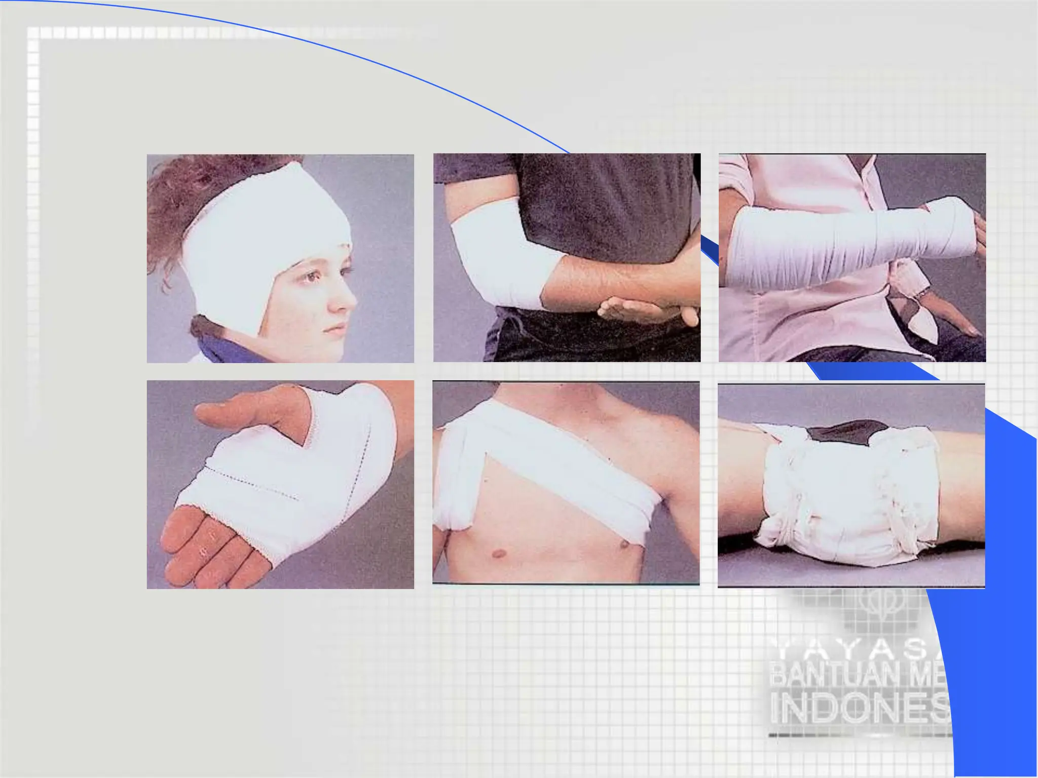 Mengenal Pembalutan dan Pembidaian Untuk pemula | PPT