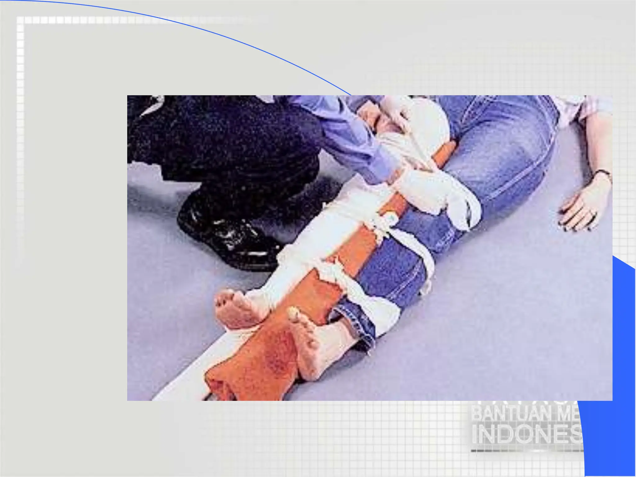 Mengenal Pembalutan dan Pembidaian Untuk pemula | PPT