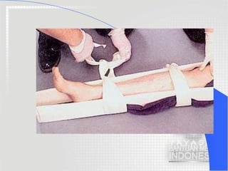 Mengenal Pembalutan dan Pembidaian Untuk pemula | PPT