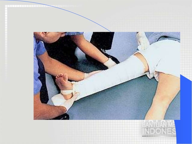 Mengenal Pembalutan dan Pembidaian Untuk pemula | PPT