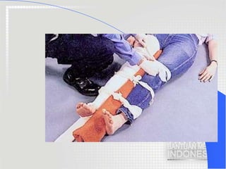 Mengenal Pembalutan dan Pembidaian Untuk pemula | PPT