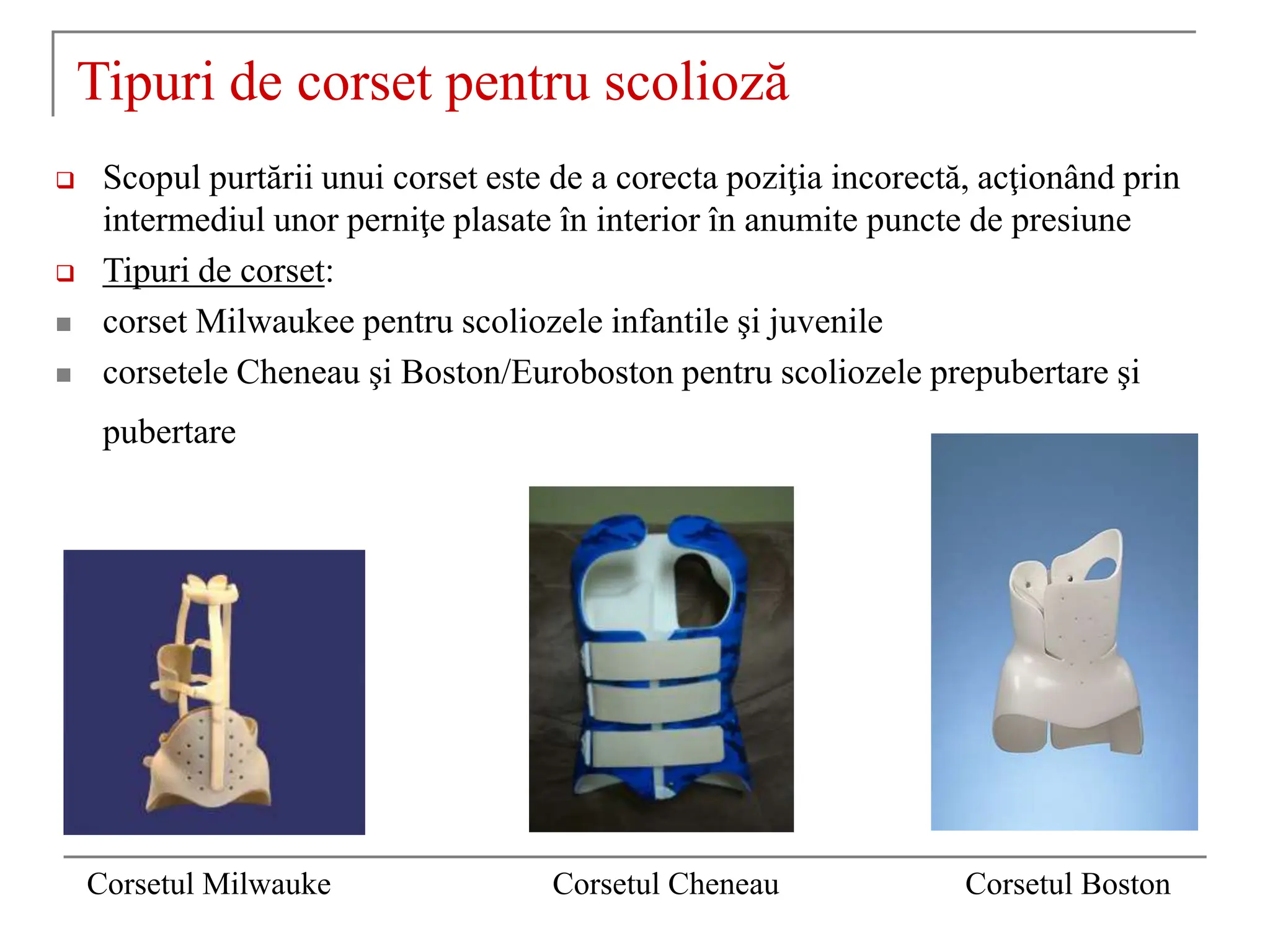 Prezentare despre deformarea coloanei vertebrale - scolioza-proiect.ppt