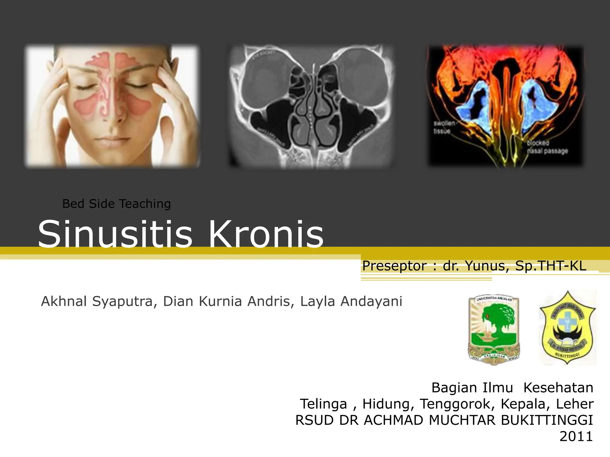 dokumen.tips_sinusitis-kronis-5597982febd21.pptx