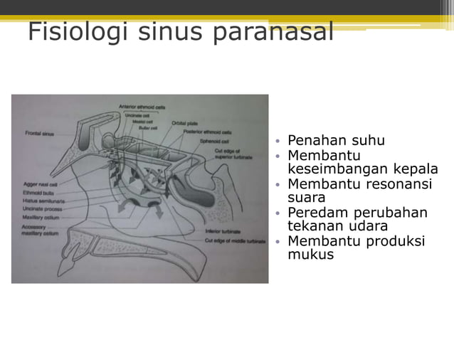 dokumen.tips_sinusitis-kronis-5597982febd21.pptx