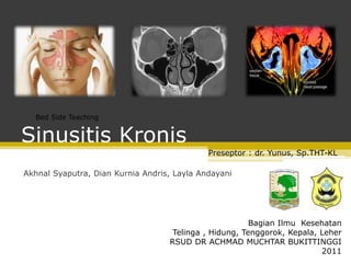 dokumen.tips_sinusitis-kronis-5597982febd21.pptx