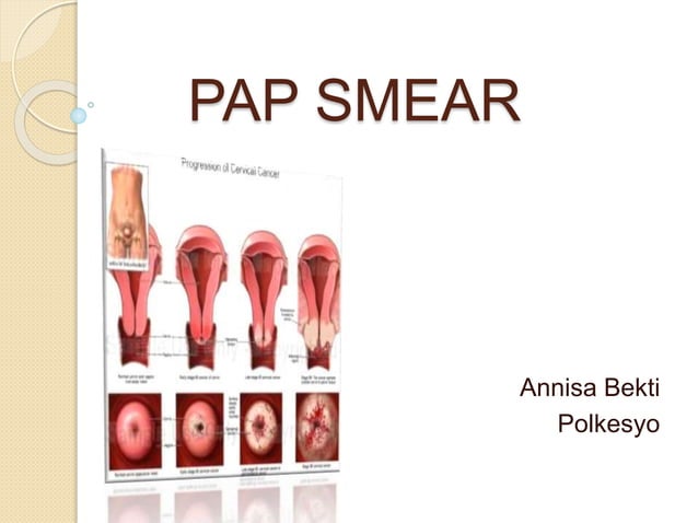 dokumen.tips_pap-smear-ppt-final.pptx_iva pap smear | PPTX