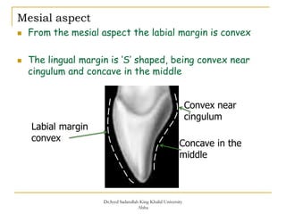 dokumen.tips_maxillary-incisorrs (2).pdf