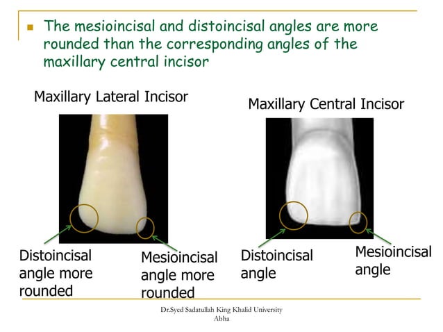 dokumen.tips_maxillary-incisorrs (2).pdf