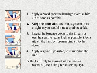 dokumen.tips_21gigitan-ular-snake-biteppt.ppt