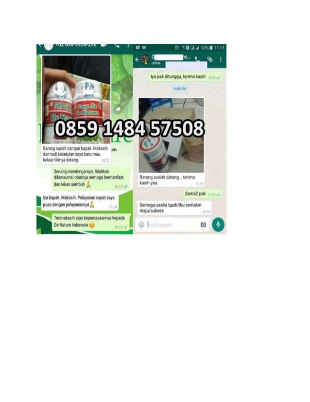 Gejala Penyakit Raja Singa Sifilis