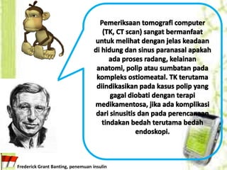 Sistem THT (Polip). Dokumentasi Keperawatan. By.Pangestu Chaesar S | PPTX