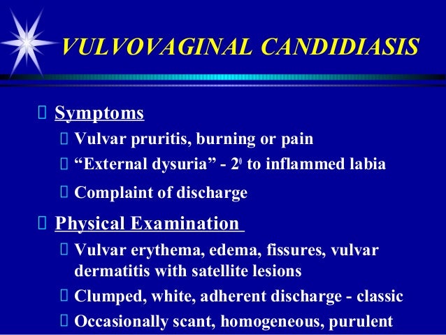 Vulvovaginal Candidiasis Symptoms Vulvovaginitis: Causes, Symptoms,