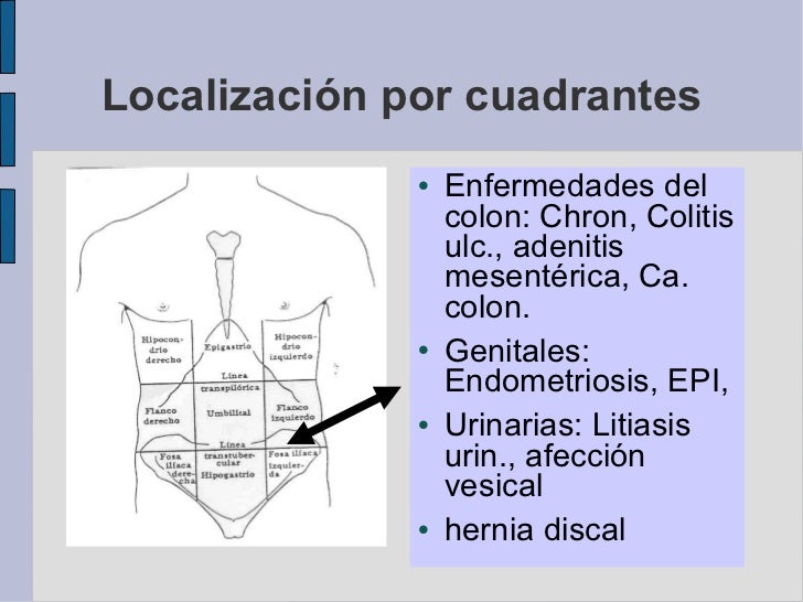 Enfermedades Por Cuadrantes Abdominales Image – IVRCQB